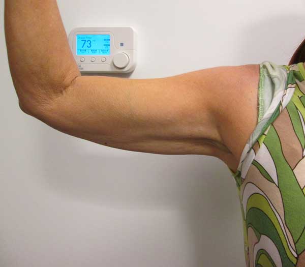 VelaShape III™ Para la reforma del cuerpo y la reducción de la ...